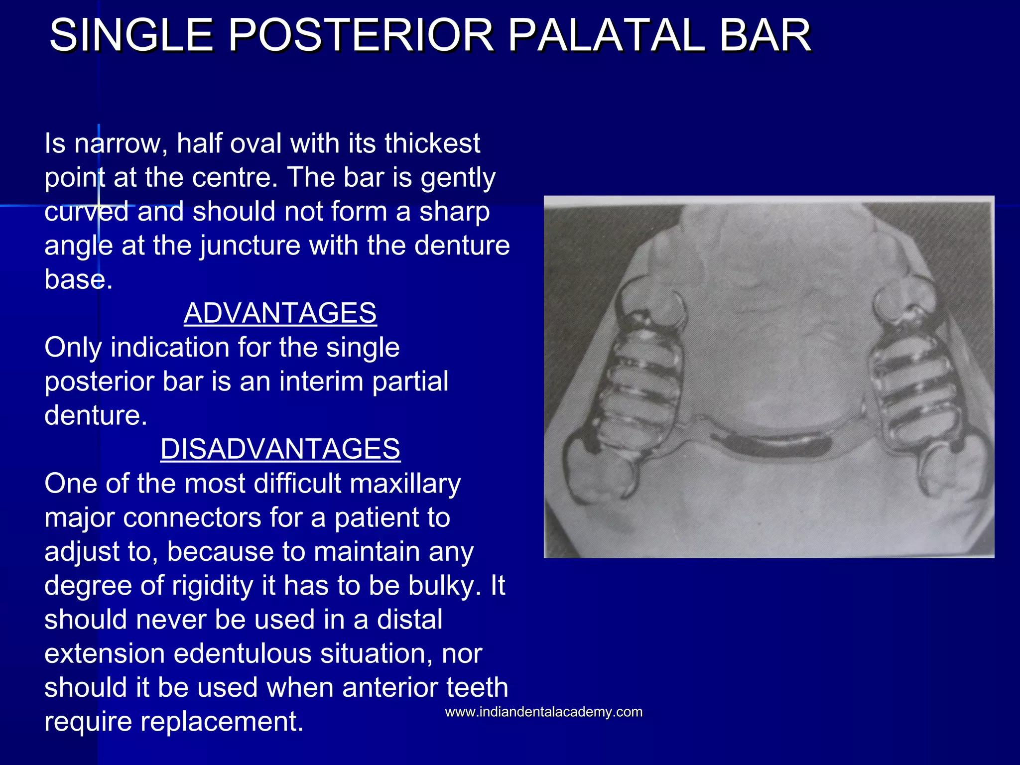 Components of removable partial denture prosthesis /certified fixed ...