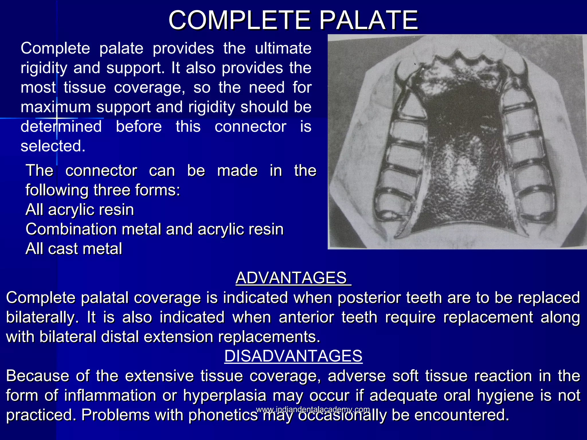 Components of removable partial denture prosthesis /certified fixed ...