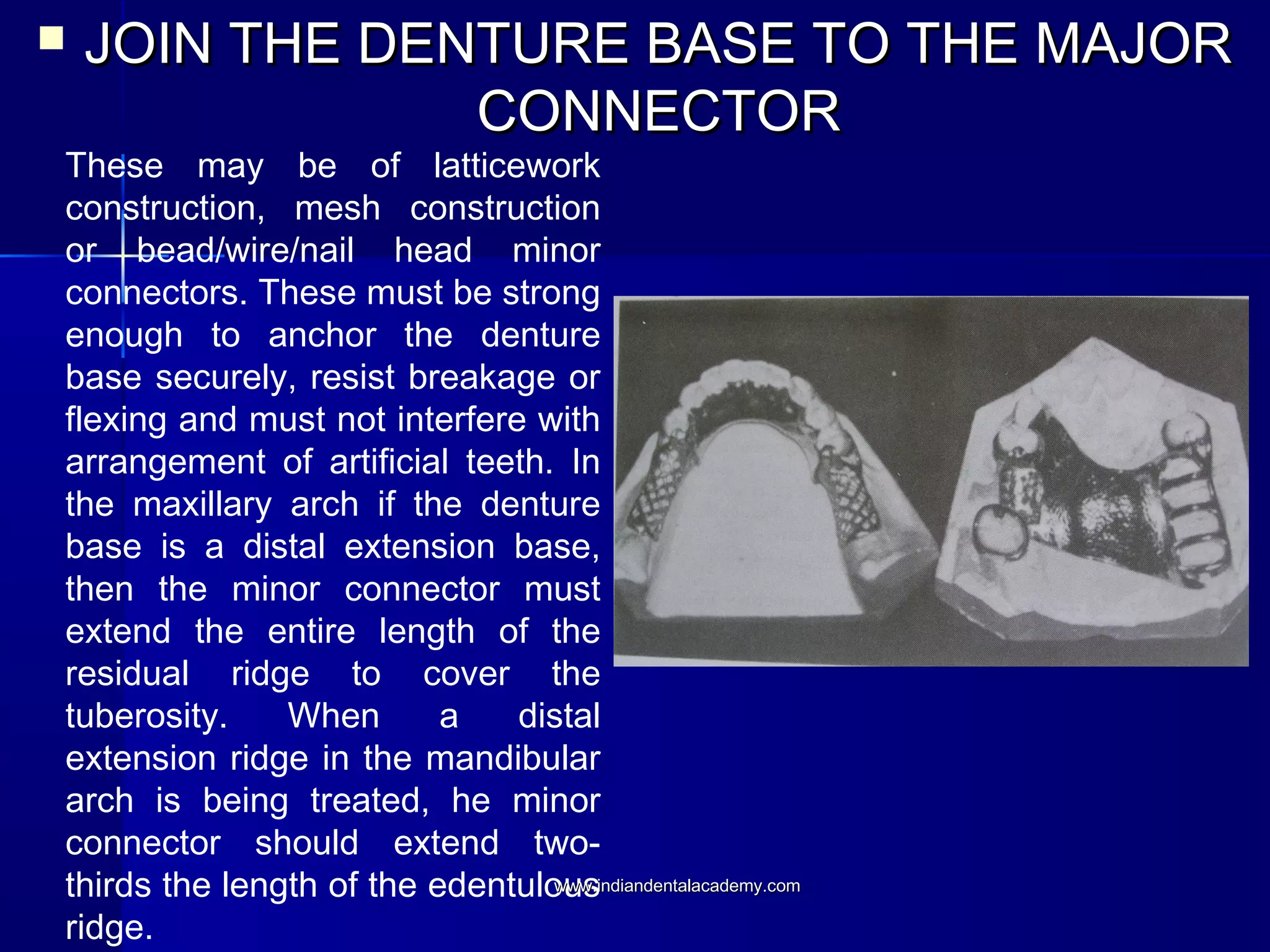 Components of removable partial denture prosthesis /certified fixed ...