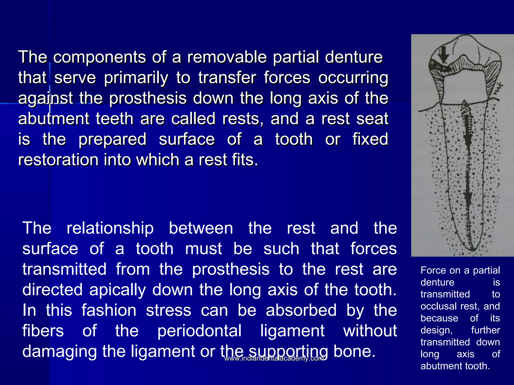 Components of removable partial denture prosthesis /certified fixed ...
