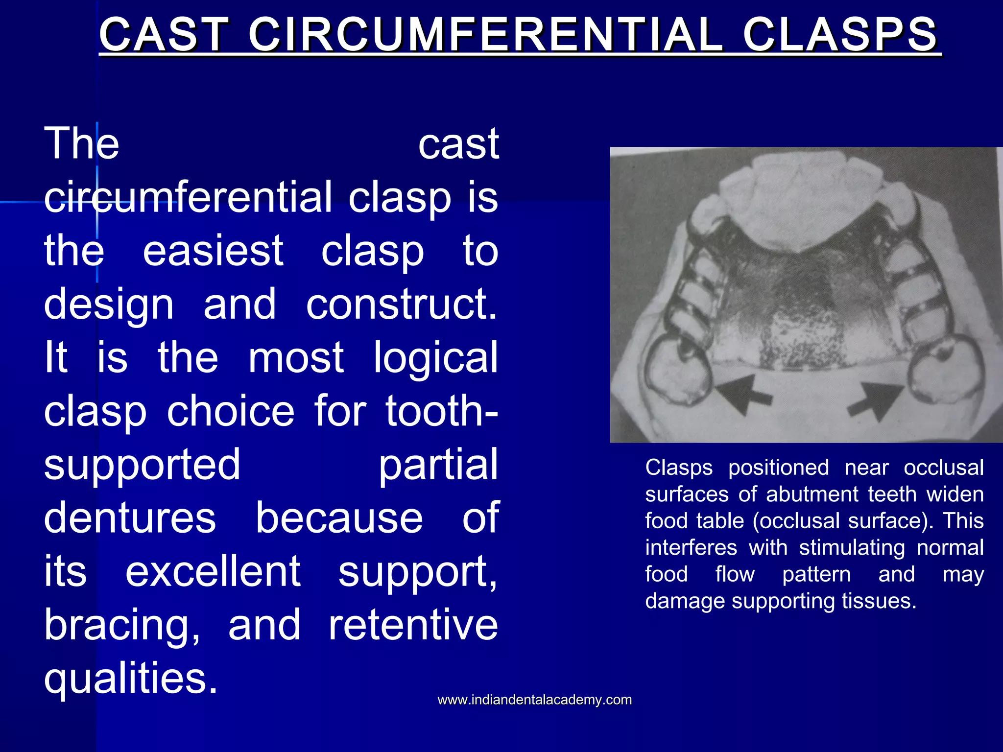 Components of removable partial denture prosthesis /certified fixed ...