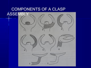 Components of removable partial denture prosthesis /certified fixed ...