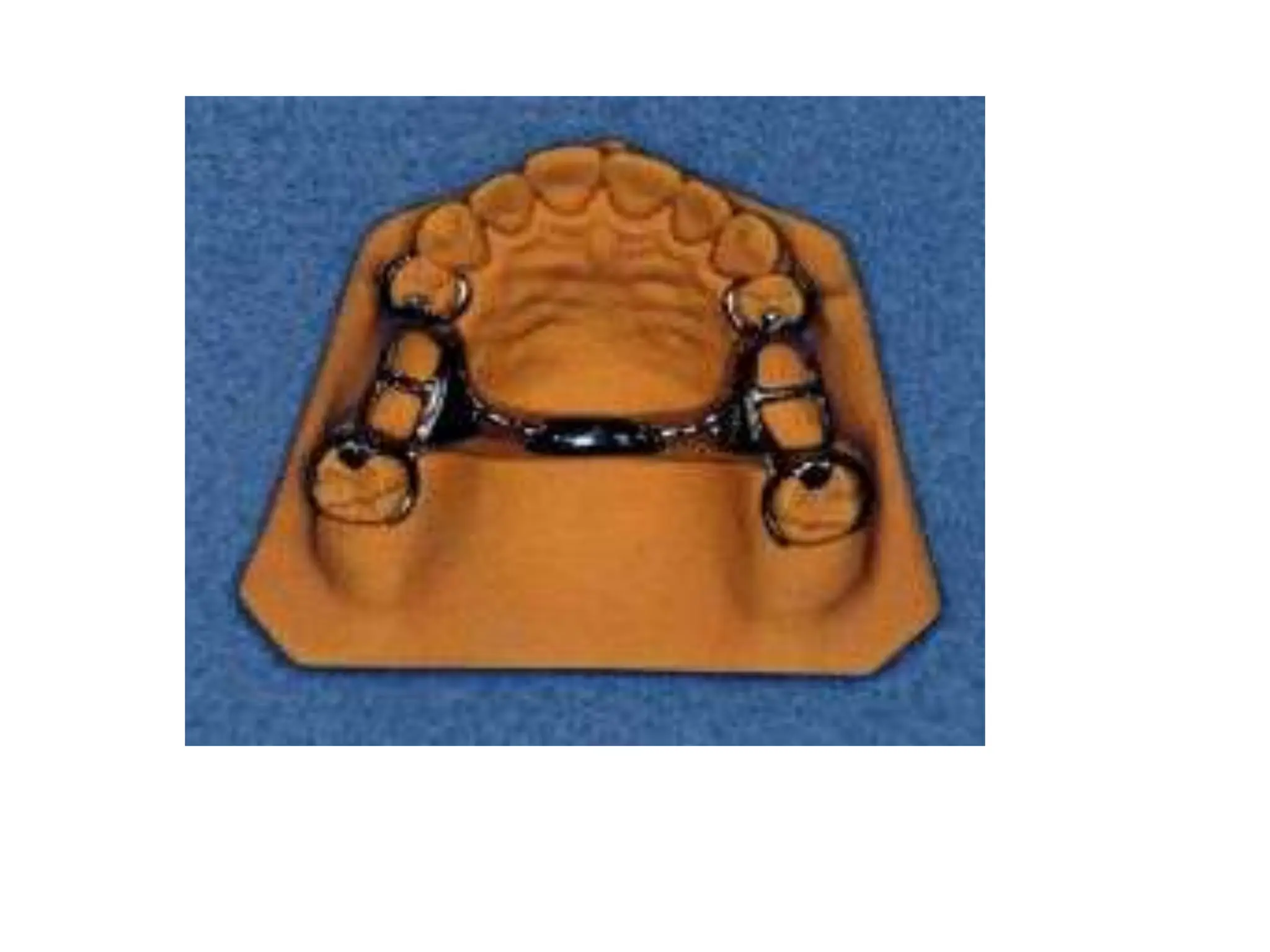 components of rpd.ppt