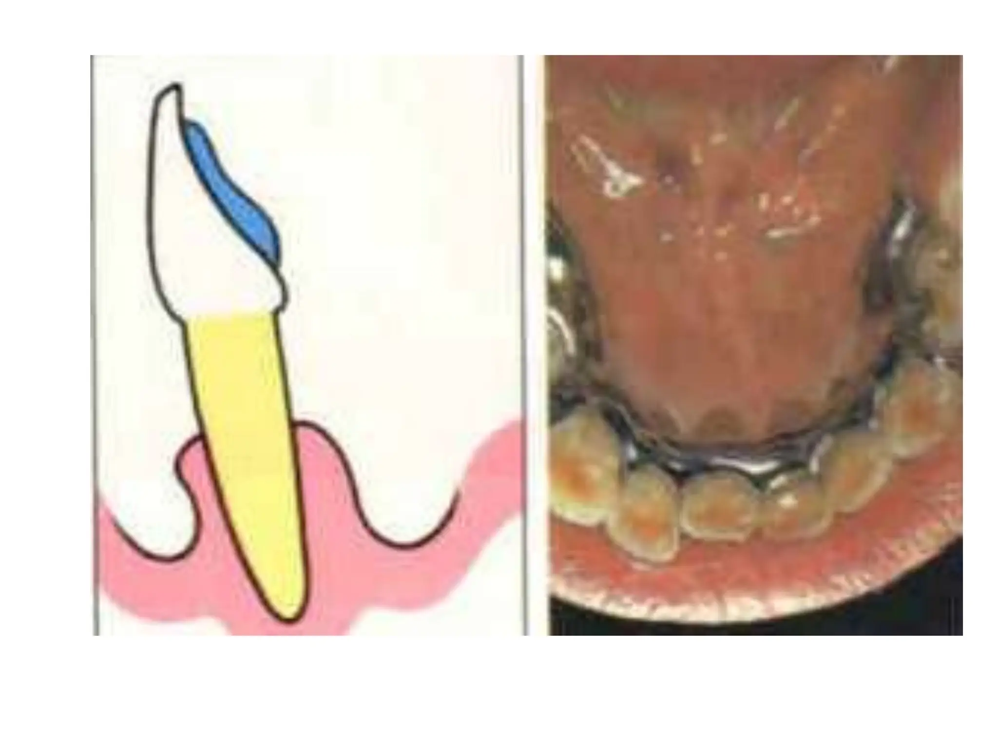 components of rpd.ppt