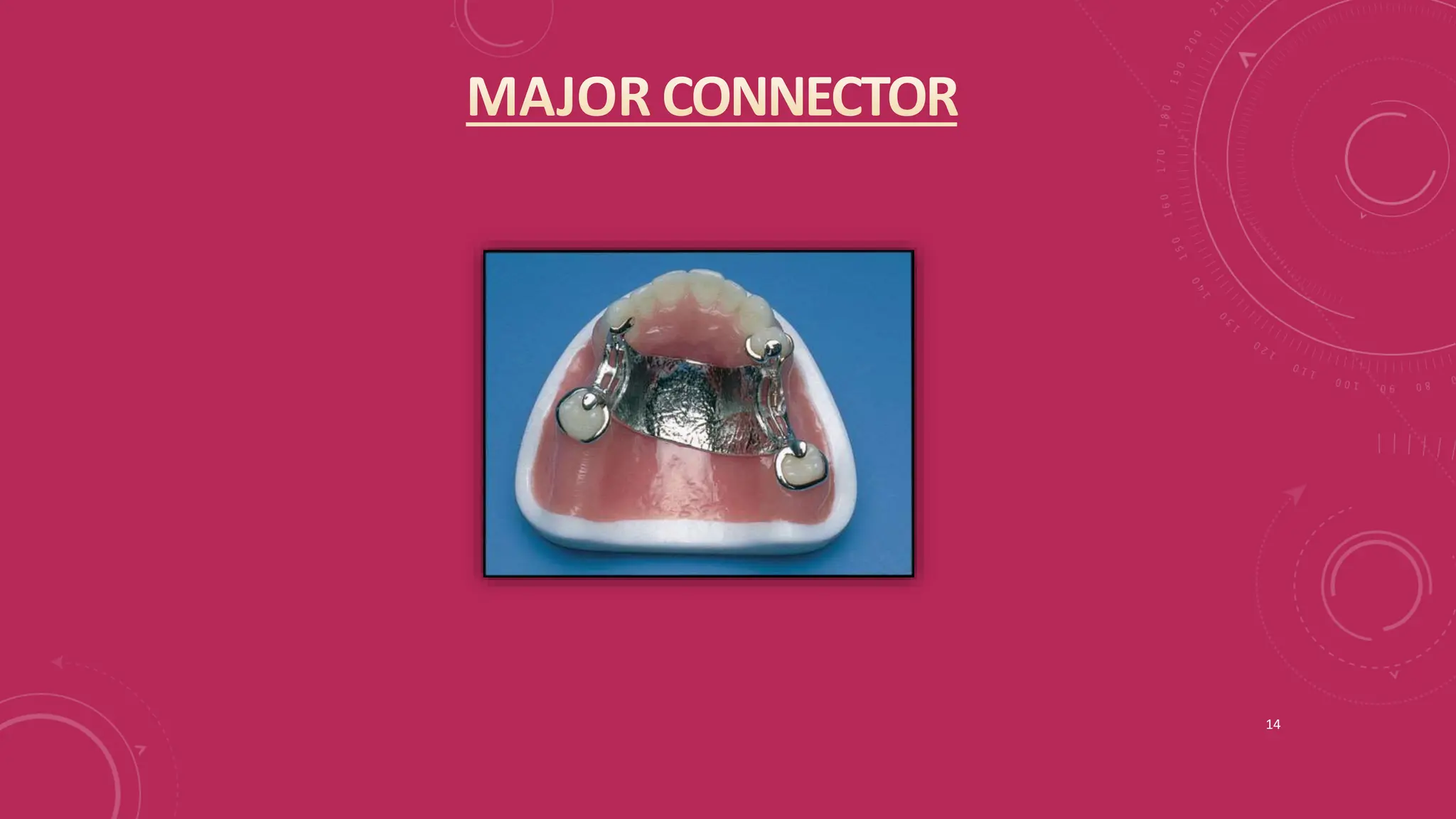 Components of RPD and Major connectors_Dr Shuchi Jain.pptx