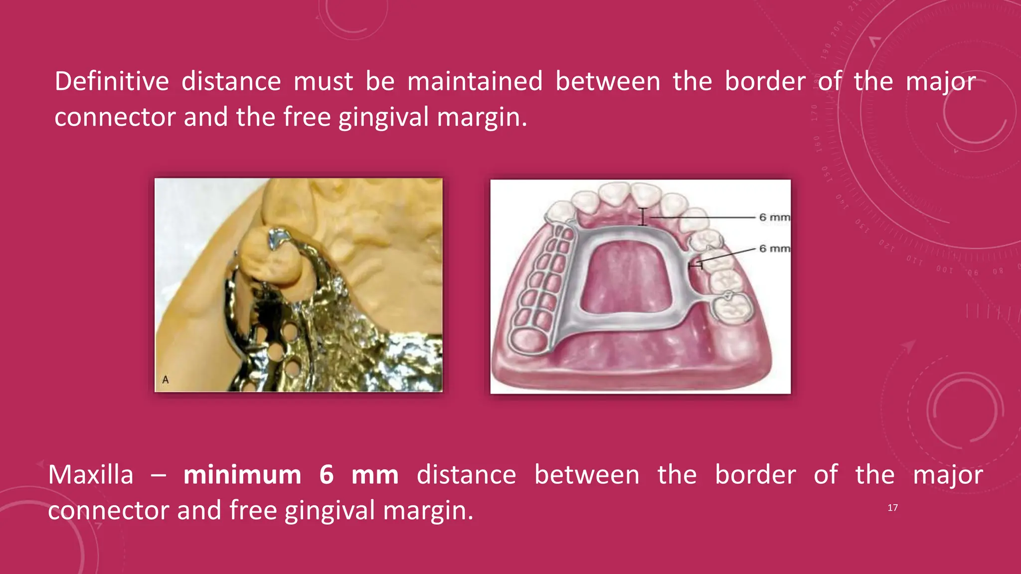 Components of RPD and Major connectors_Dr Shuchi Jain.pptx