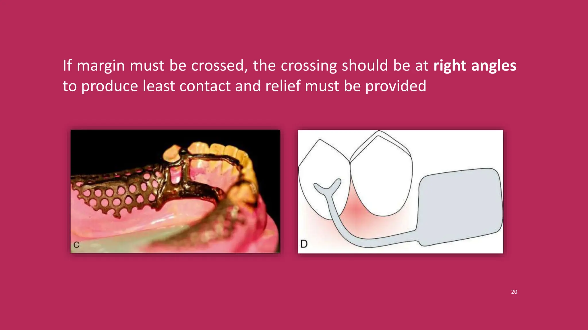 Components of RPD and Major connectors_Dr Shuchi Jain.pptx
