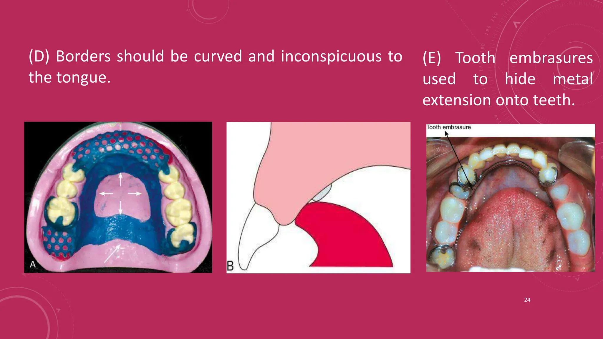 Components of RPD and Major connectors_Dr Shuchi Jain.pptx