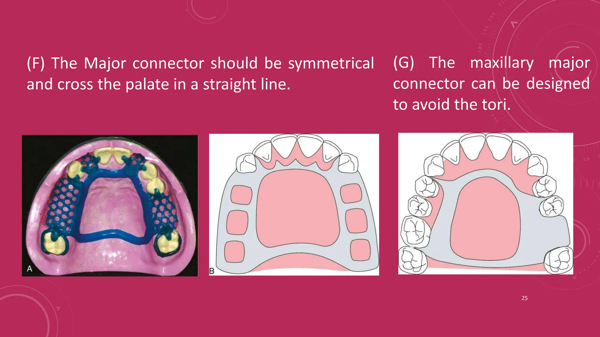Components of RPD and Major connectors_Dr Shuchi Jain.pptx