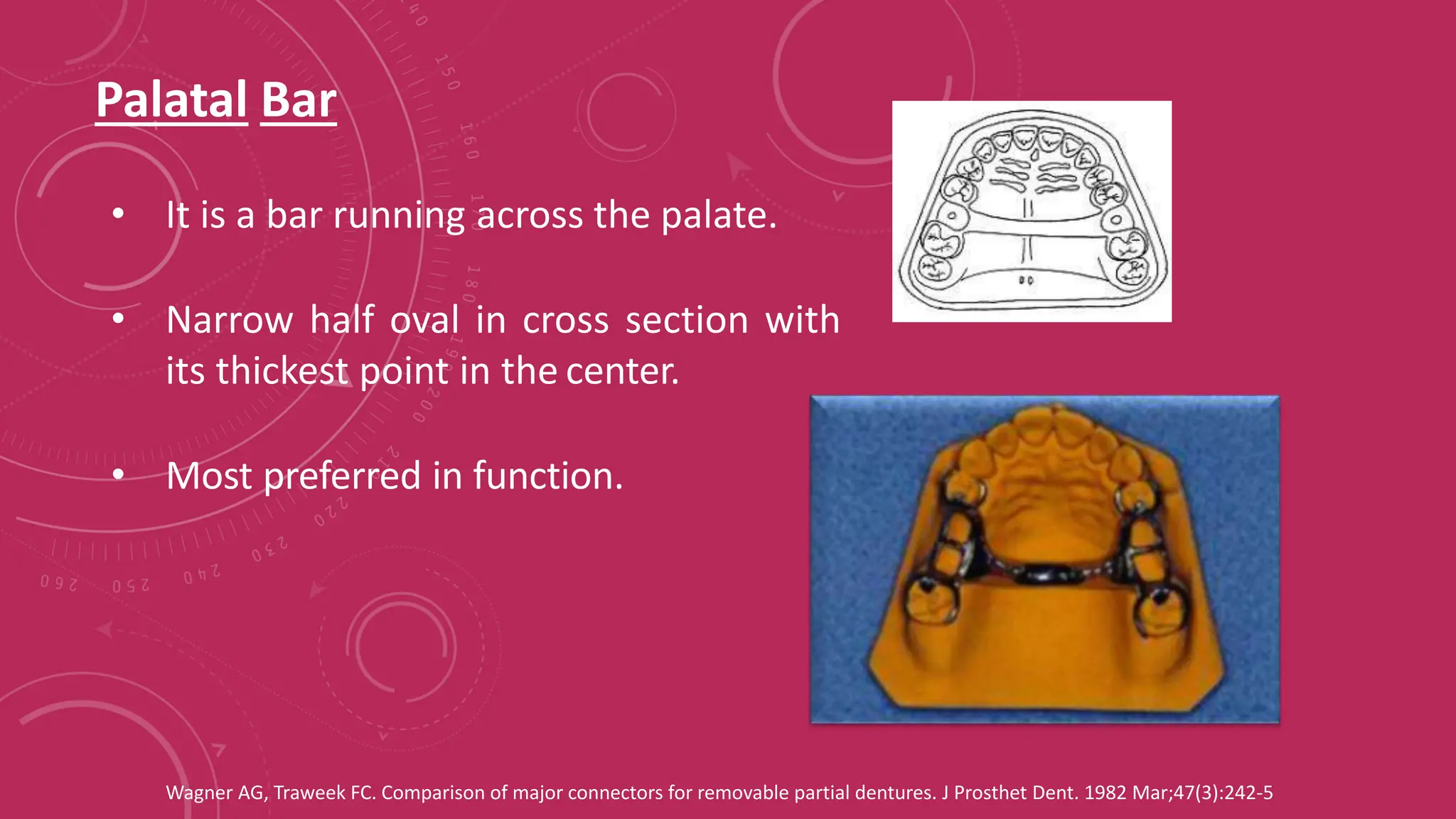 Components of RPD and Major connectors_Dr Shuchi Jain.pptx