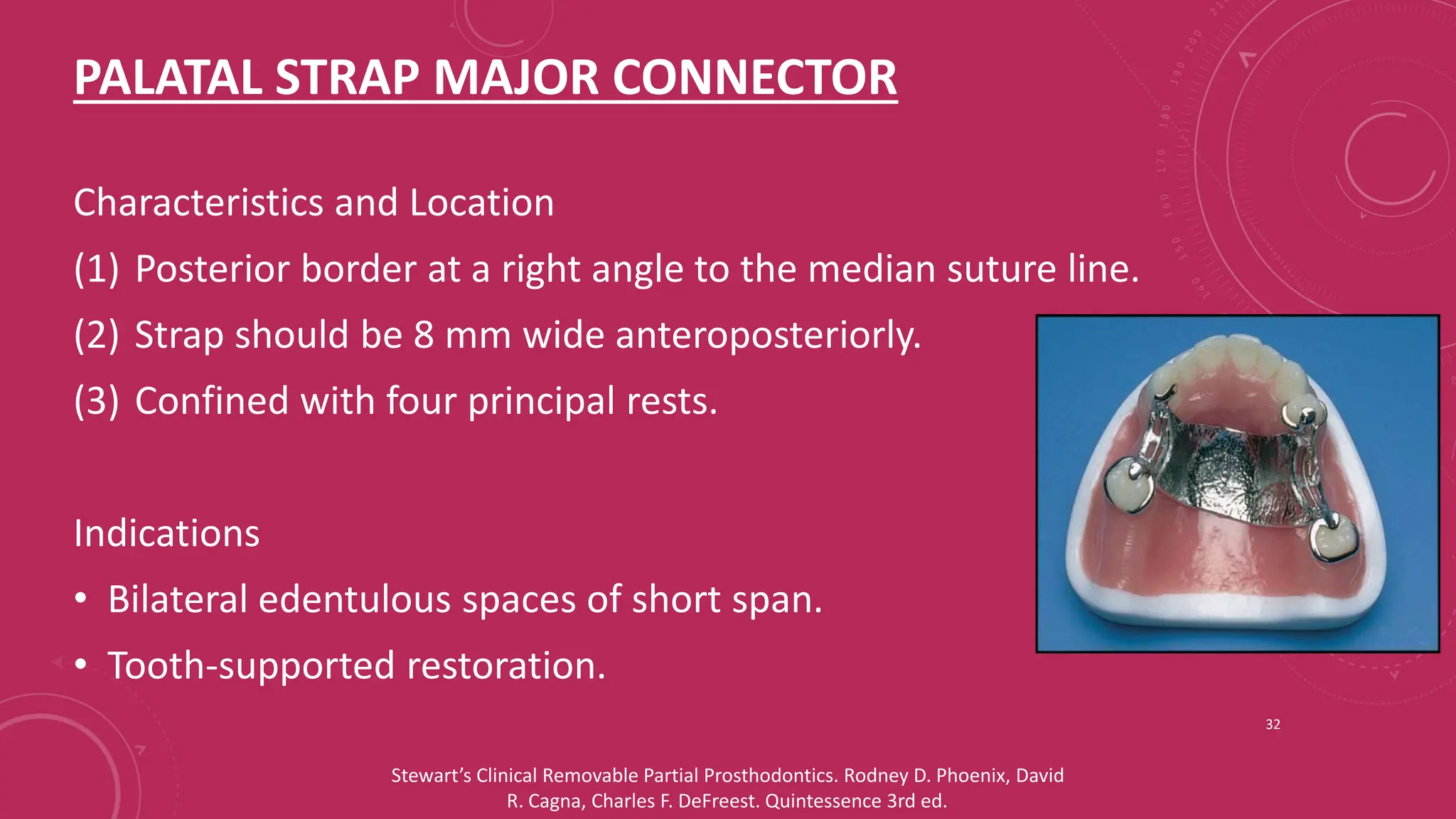 Components of RPD and Major connectors_Dr Shuchi Jain.pptx