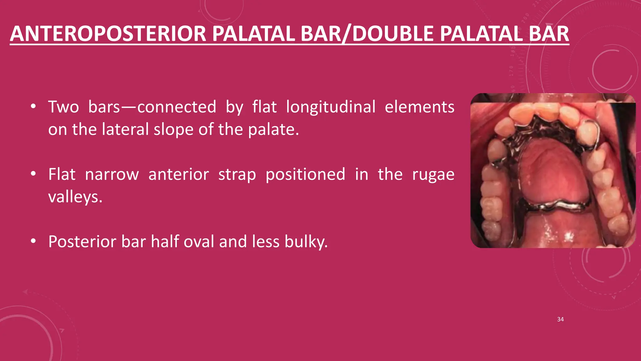 Components of RPD and Major connectors_Dr Shuchi Jain.pptx