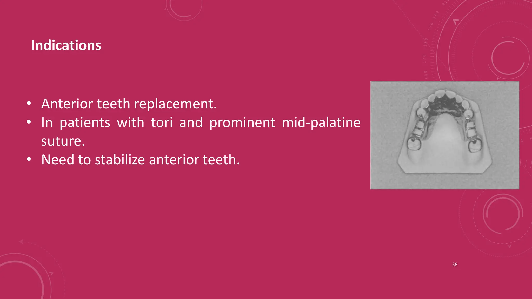 Components of RPD and Major connectors_Dr Shuchi Jain.pptx