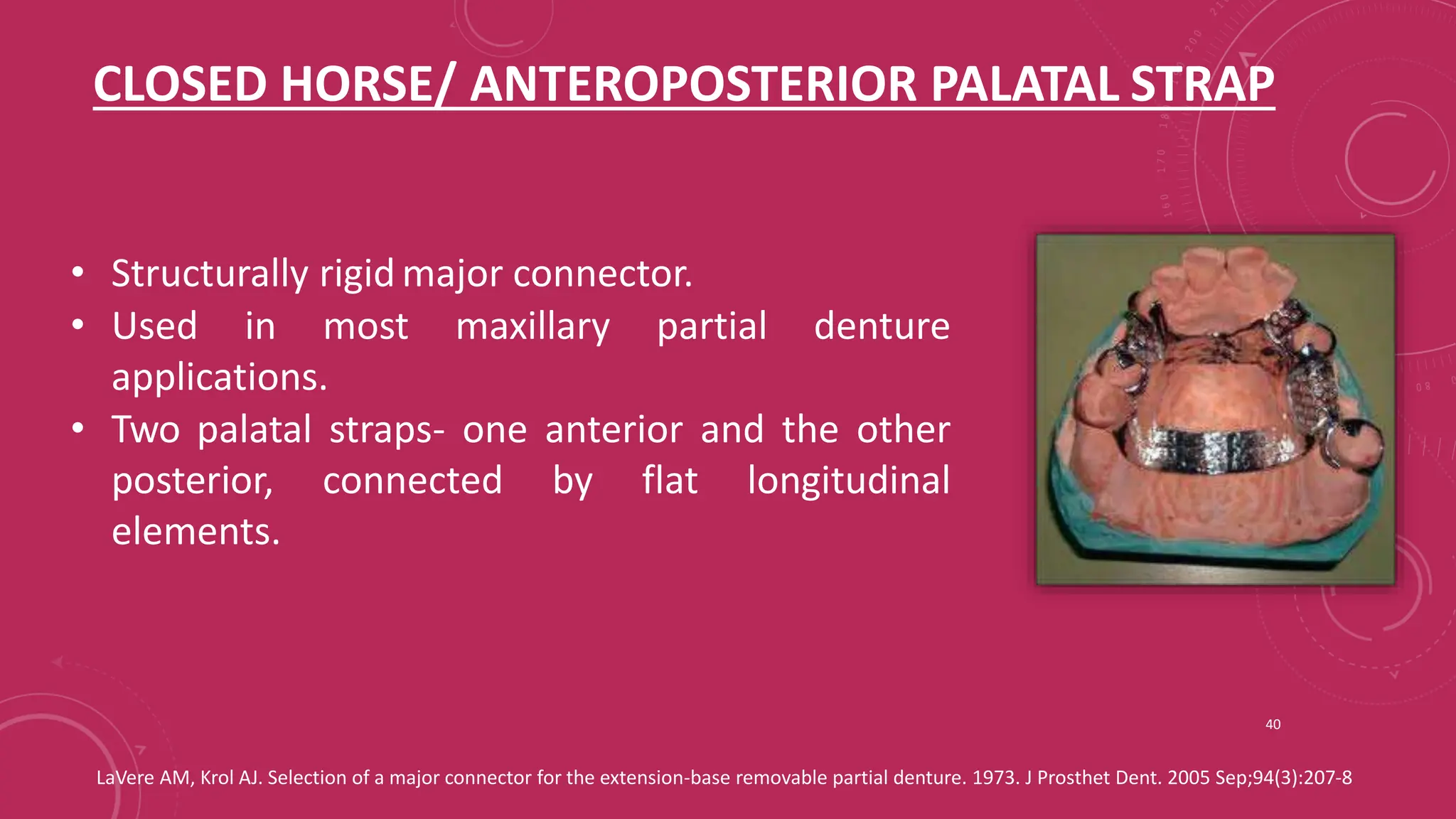 Components of RPD and Major connectors_Dr Shuchi Jain.pptx