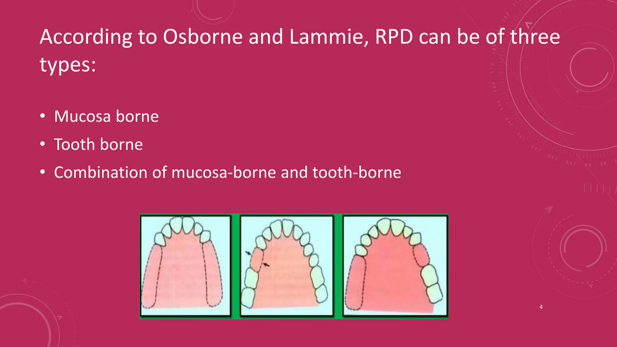 Components of RPD and Major connectors_Dr Shuchi Jain.pptx