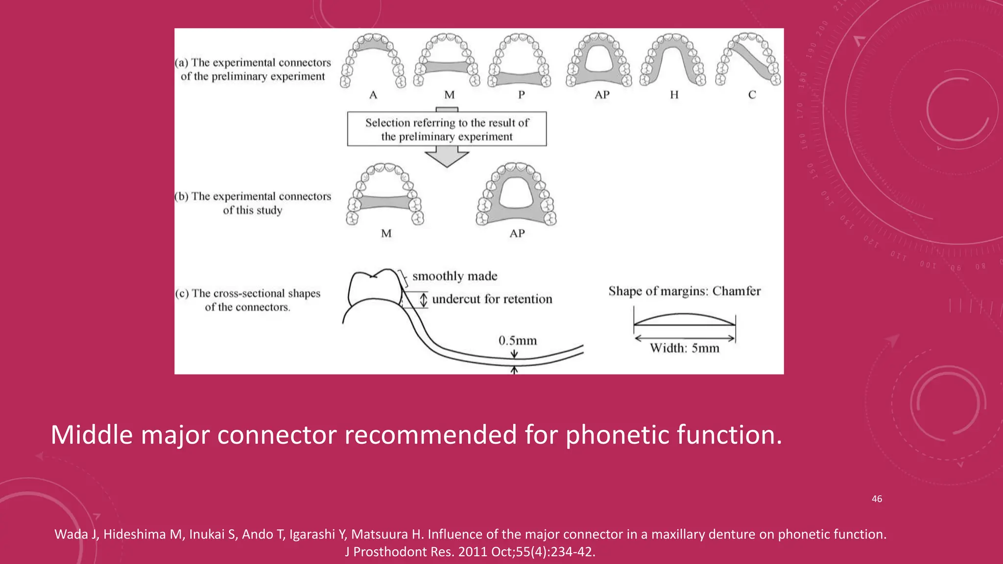 Components of RPD and Major connectors_Dr Shuchi Jain.pptx