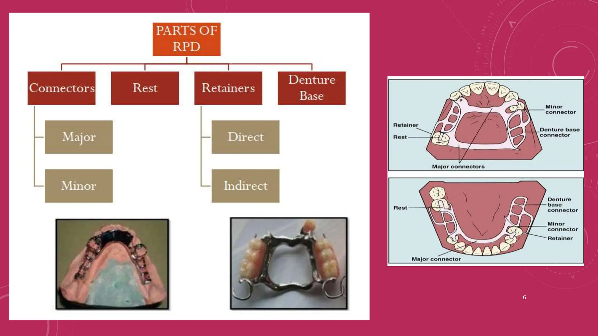 Components of RPD and Major connectors_Dr Shuchi Jain.pptx