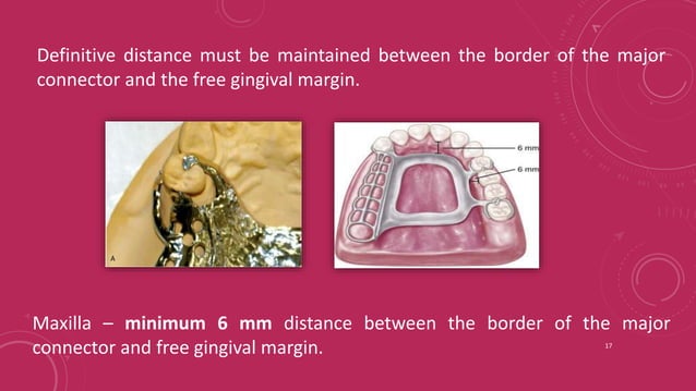 Components of RPD and Major connectors_Dr Shuchi Jain.pptx