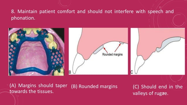 Components of RPD and Major connectors_Dr Shuchi Jain.pptx