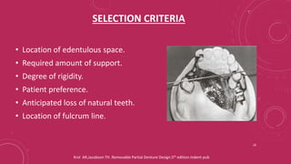 Components of RPD and Major connectors_Dr Shuchi Jain.pptx