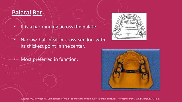 Components of RPD and Major connectors_Dr Shuchi Jain.pptx