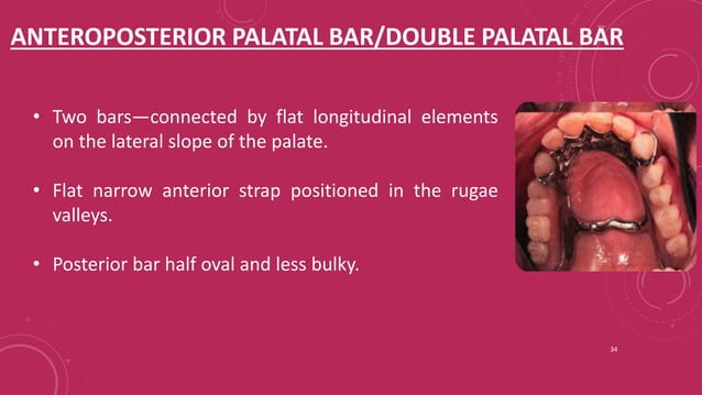 Components of RPD and Major connectors_Dr Shuchi Jain.pptx