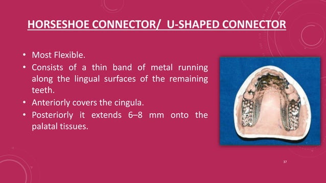 Components of RPD and Major connectors_Dr Shuchi Jain.pptx
