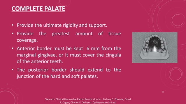 Components of RPD and Major connectors_Dr Shuchi Jain.pptx