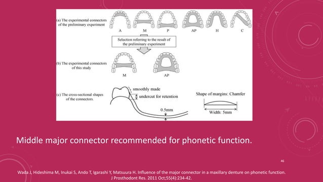 Components of RPD and Major connectors_Dr Shuchi Jain.pptx
