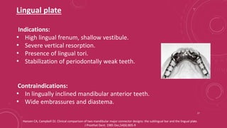 Components of RPD and Major connectors_Dr Shuchi Jain.pptx