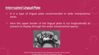Components of RPD and Major connectors_Dr Shuchi Jain.pptx