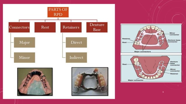 Components of RPD and Major connectors_Dr Shuchi Jain.pptx