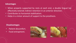 Components of RPD and Major connectors_Dr Shuchi Jain.pptx