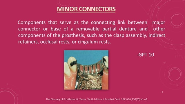 Components of RPD and Major connectors_Dr Shuchi Jain.pptx