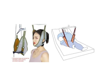 COMPONENTS OF TRACTION.pptin orthopaedics | PPTX