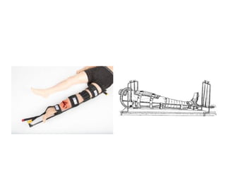 COMPONENTS OF TRACTION.pptin orthopaedics | PPTX