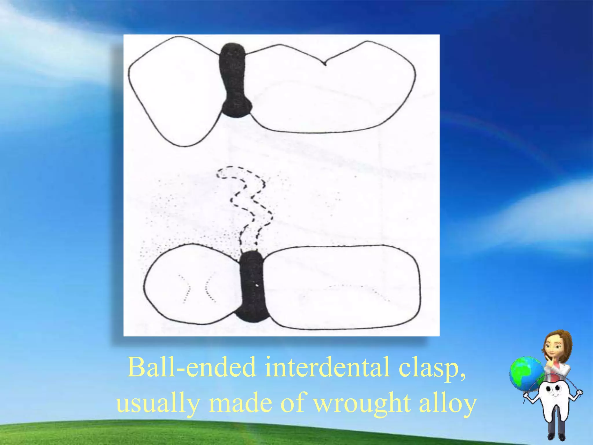 Component Parts of A Partial Denture | PPTX