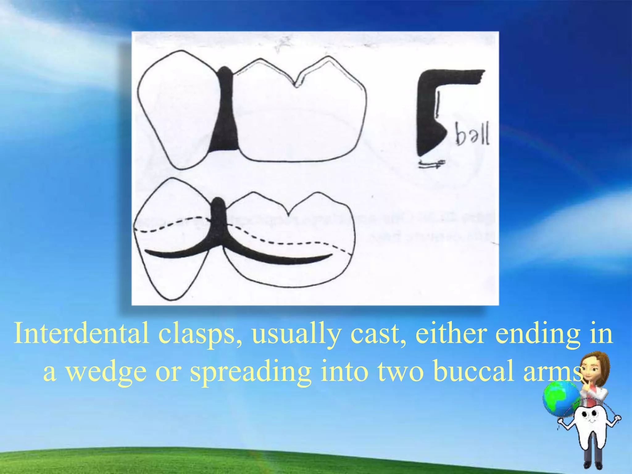 Component Parts of A Partial Denture | PPTX
