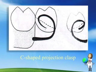 Component Parts of A Partial Denture | PPTX