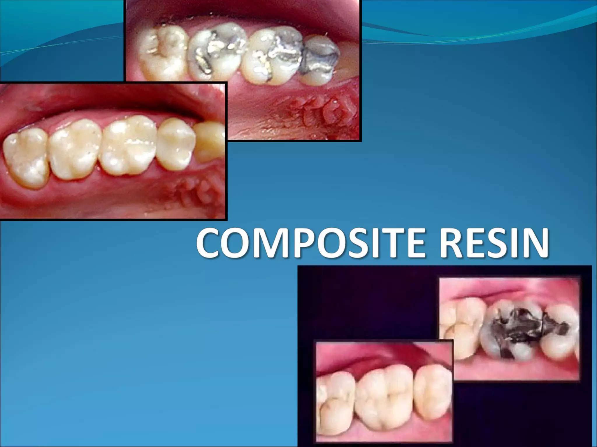 Composite | PPT