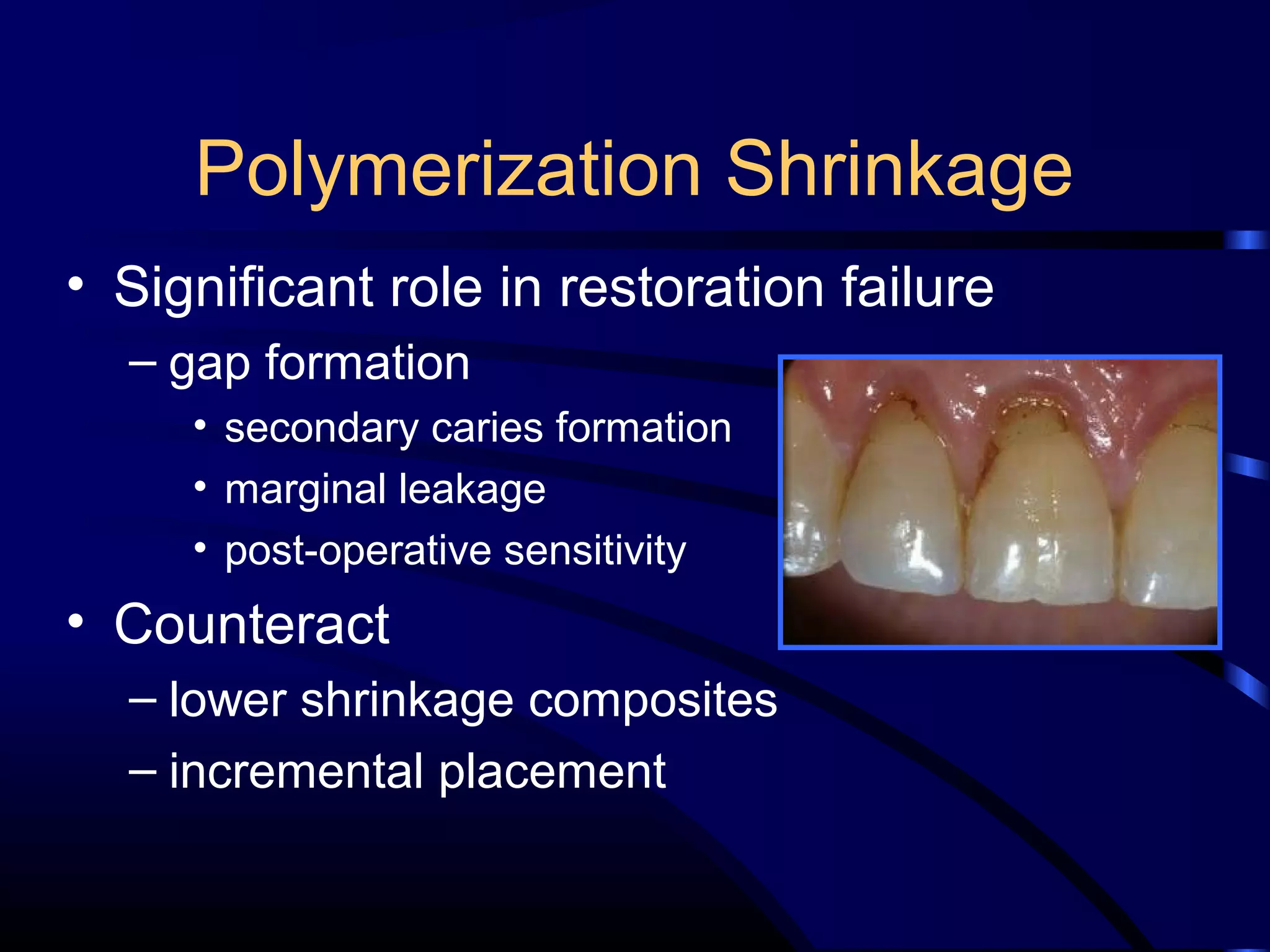 Composite and acid etching | PPT
