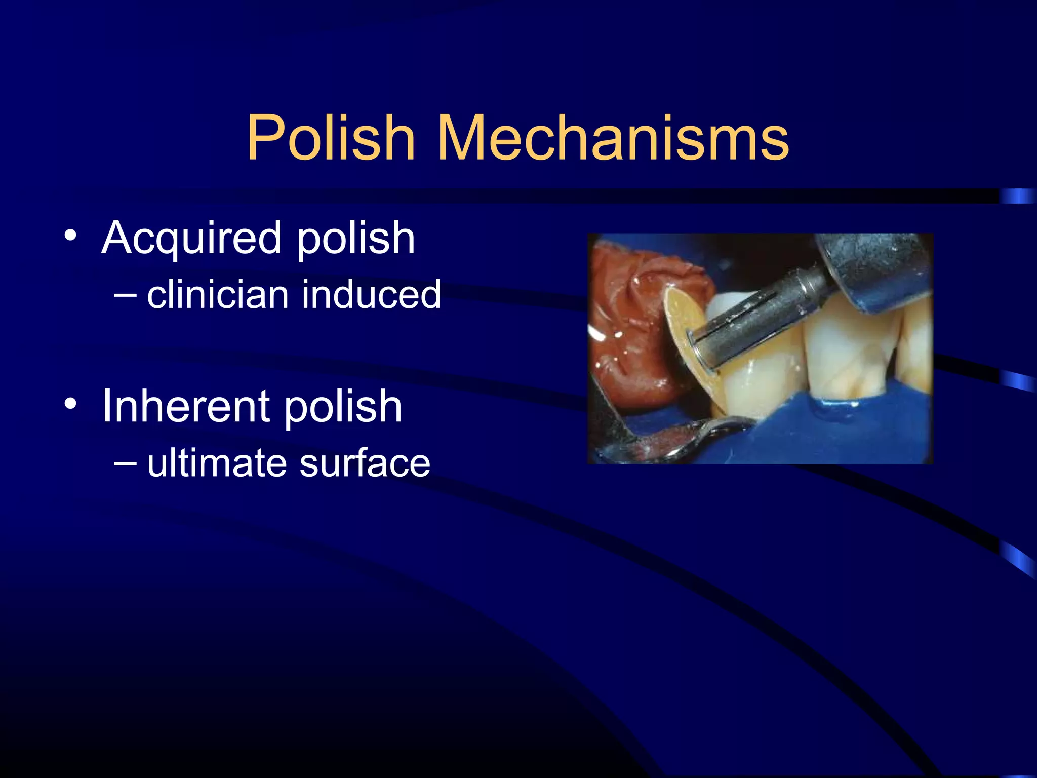 Composite and acid etching | PPT