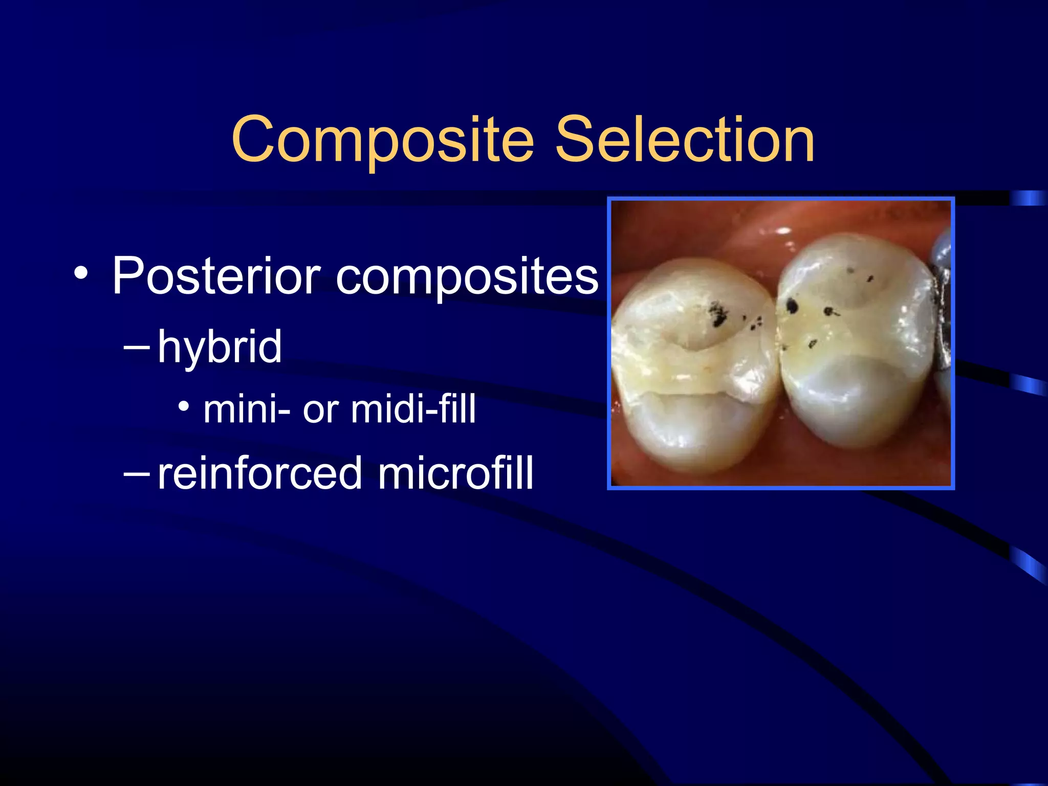 Composite and acid etching | PPT