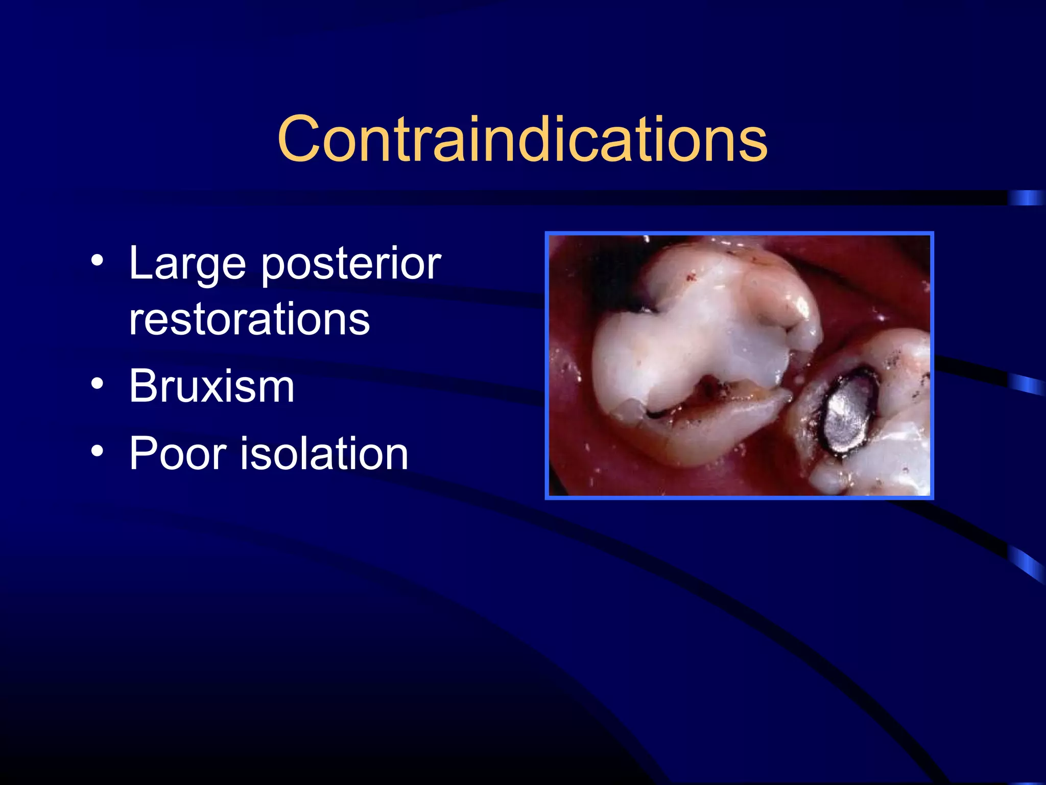 Composite and acid etching | PPT