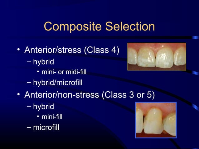 Composite and acid etching | PPT | Skin Care | Beauty