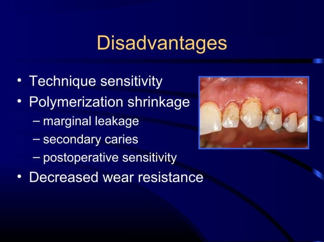 Composite and acid etching | PPT | Skin Care | Beauty