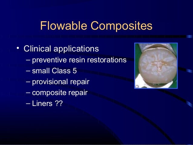 Composite and acid etching