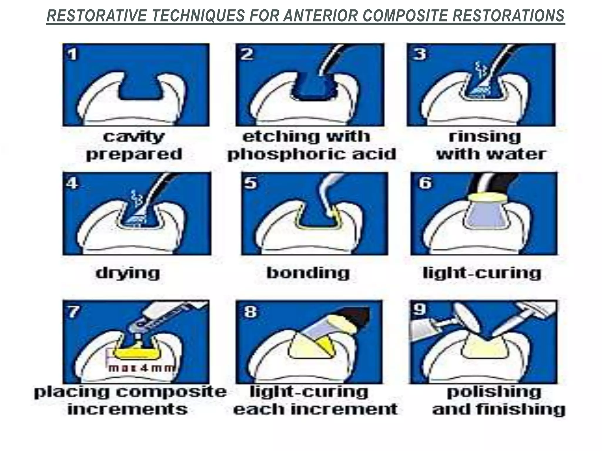 anterior composite restoration | PPTX