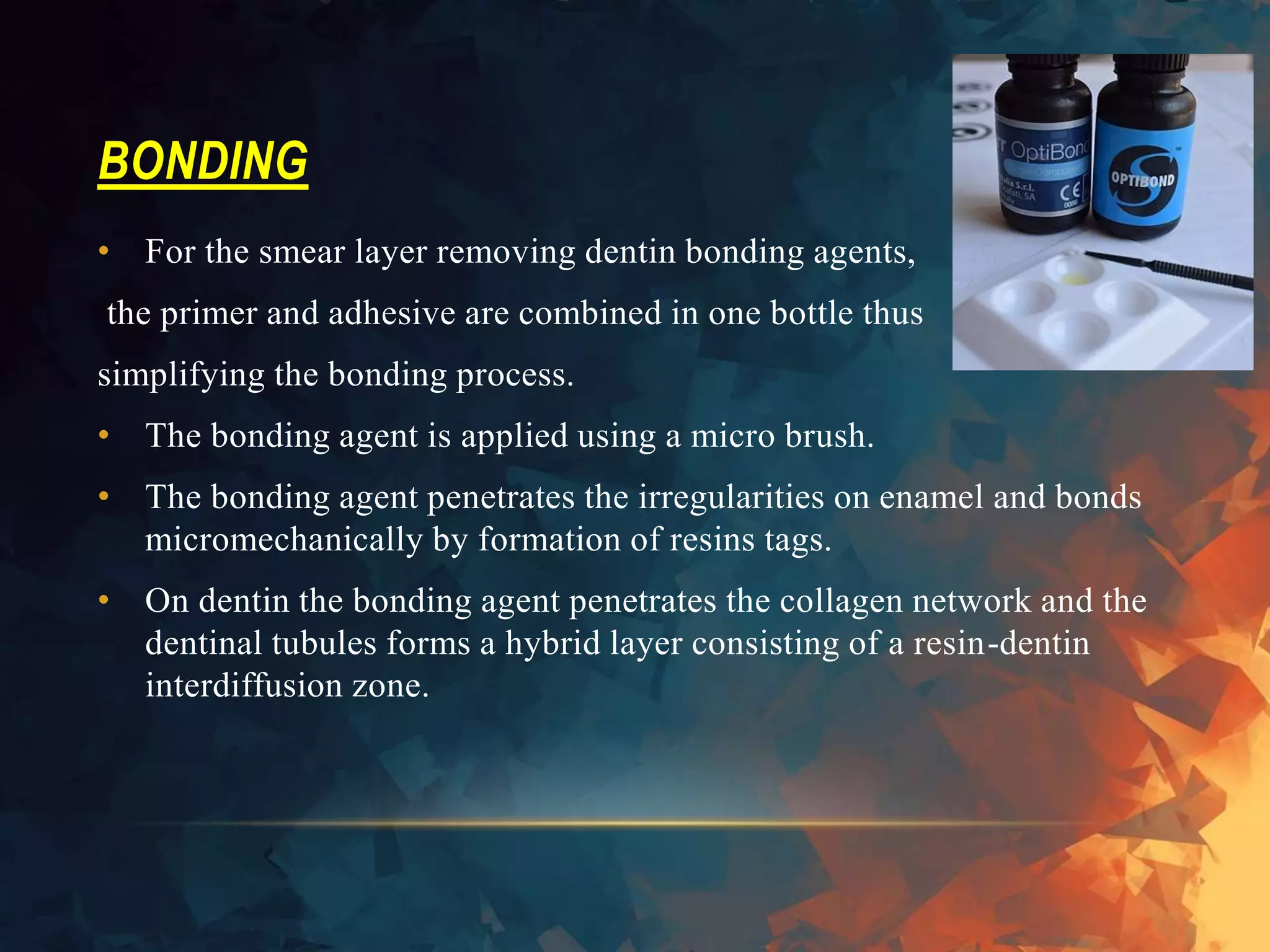 anterior composite restoration | PPTX