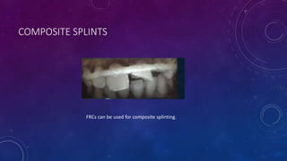 Composite resins I | PPTX
